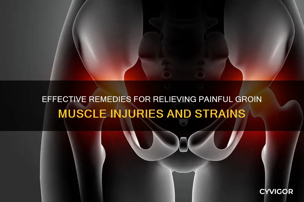 Effective Remedies For Relieving Painful Groin Muscle Injuries And ...