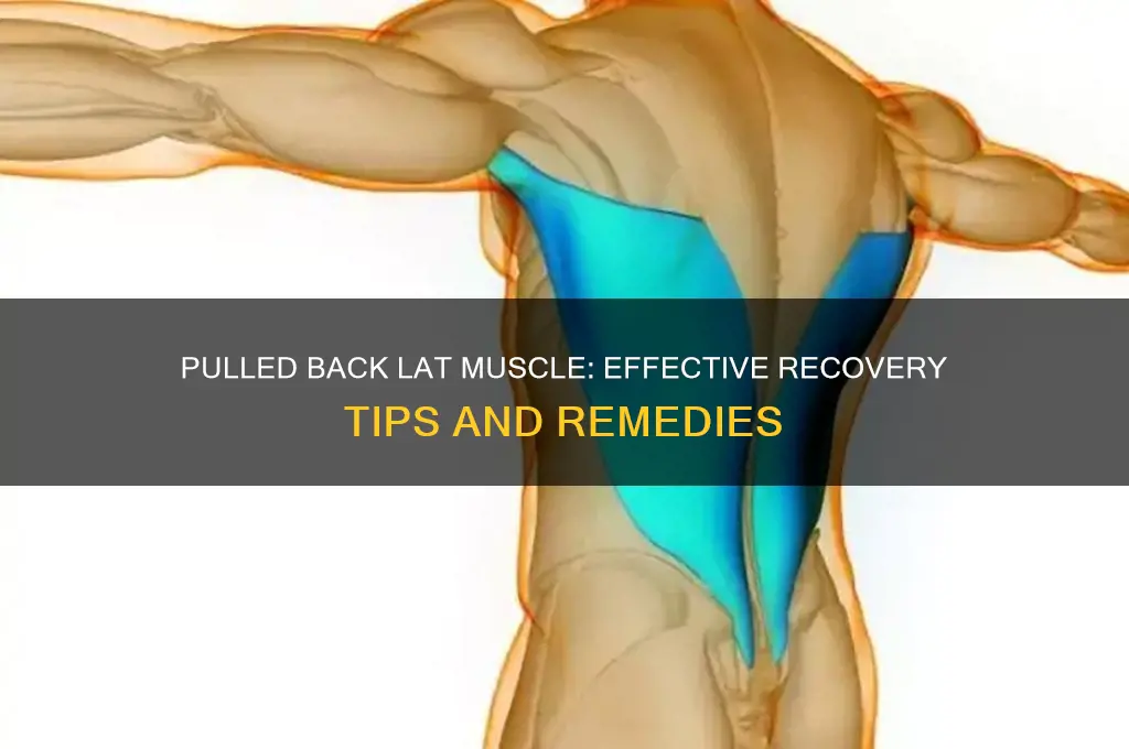 Pulled Back Lat Muscle: Effective Recovery Tips And Remedies | CyVigor