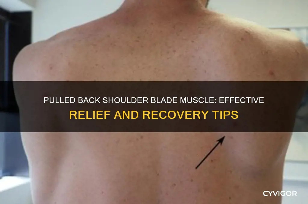 Pulled Back Shoulder Blade Muscle: Effective Relief And Recovery Tips ...
