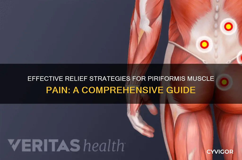Effective Relief Strategies For Piriformis Muscle Pain: A Comprehensive ...