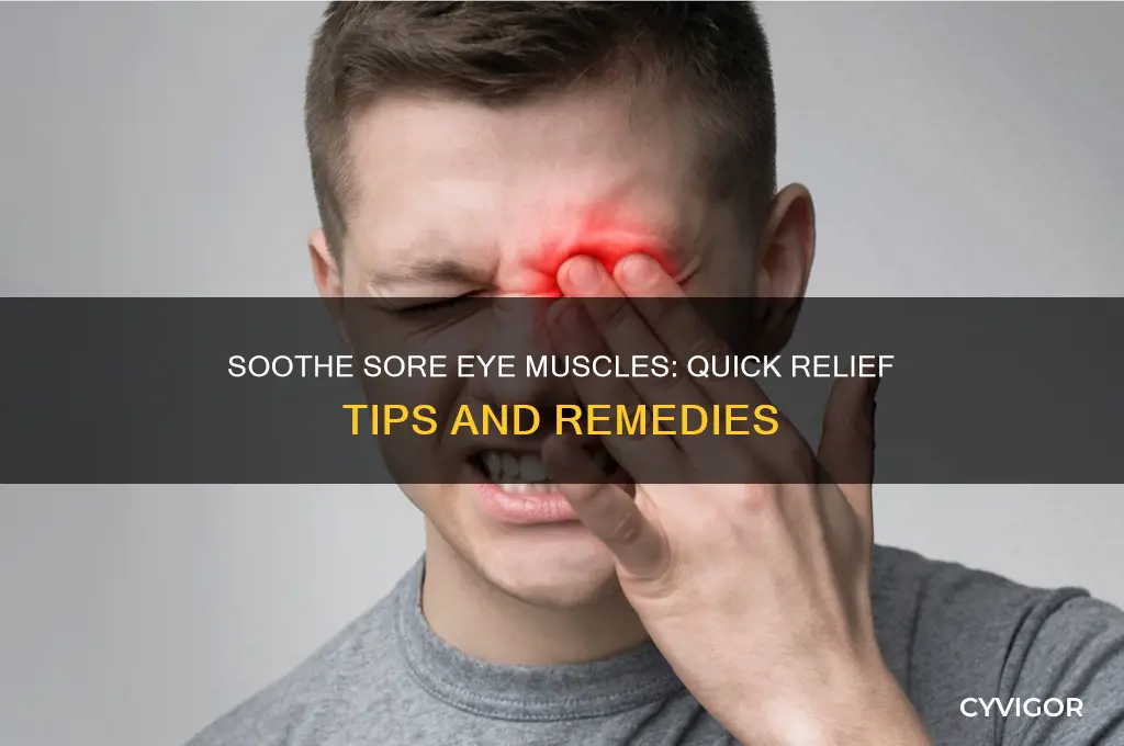 Soothe Sore Eye Muscles: Quick Relief Tips And Remedies | CyVigor