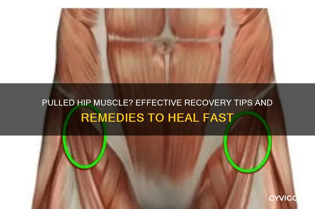 Pulled Hip Muscle? Effective Recovery Tips And Remedies To Heal Fast ...