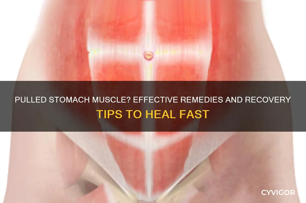 Pulled Stomach Muscle? Effective Remedies And Recovery Tips To Heal ...