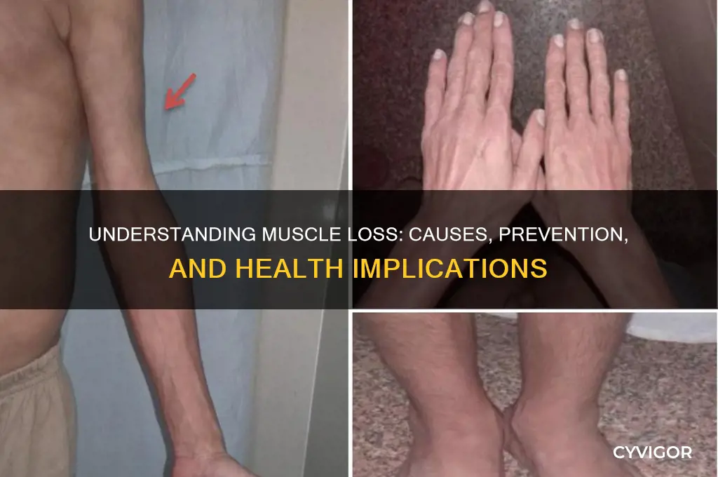 Understanding Muscle Loss: Causes, Prevention, And Health Implications ...