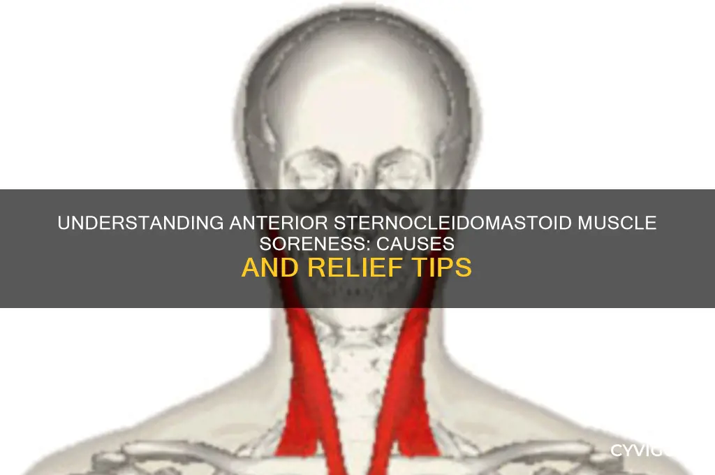 Understanding Anterior Sternocleidomastoid Muscle Soreness: Causes And ...