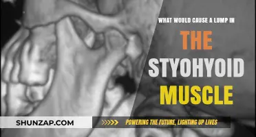 Understanding Abdominal Muscle Spasms: Causes, Symptoms, And Effective ...