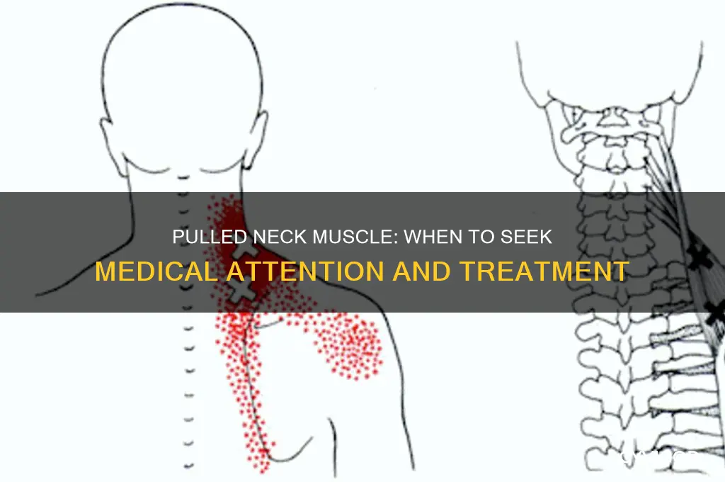 Pulled Neck Muscle: When To Seek Medical Attention And Treatment | CyVigor