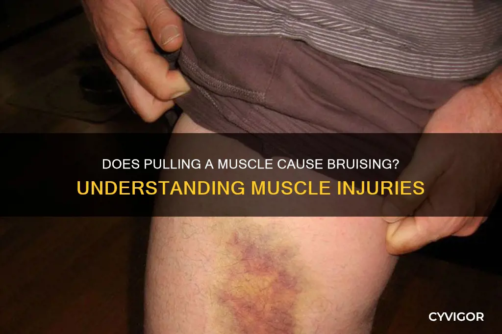 Does Pulling A Muscle Cause Bruising? Understanding Muscle Injuries ...