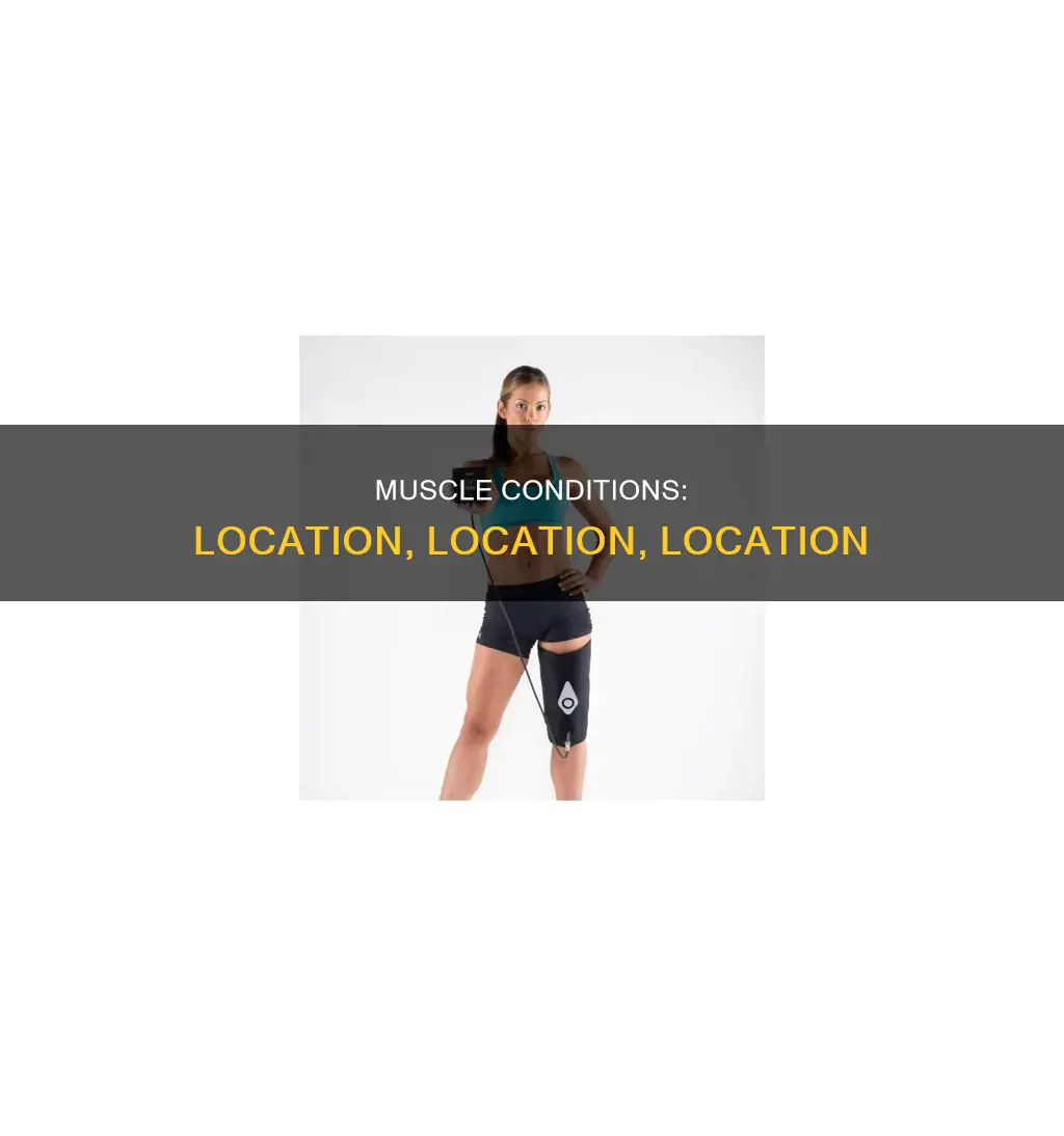 Muscle Conditions: Location, Location, Location | CyVigor