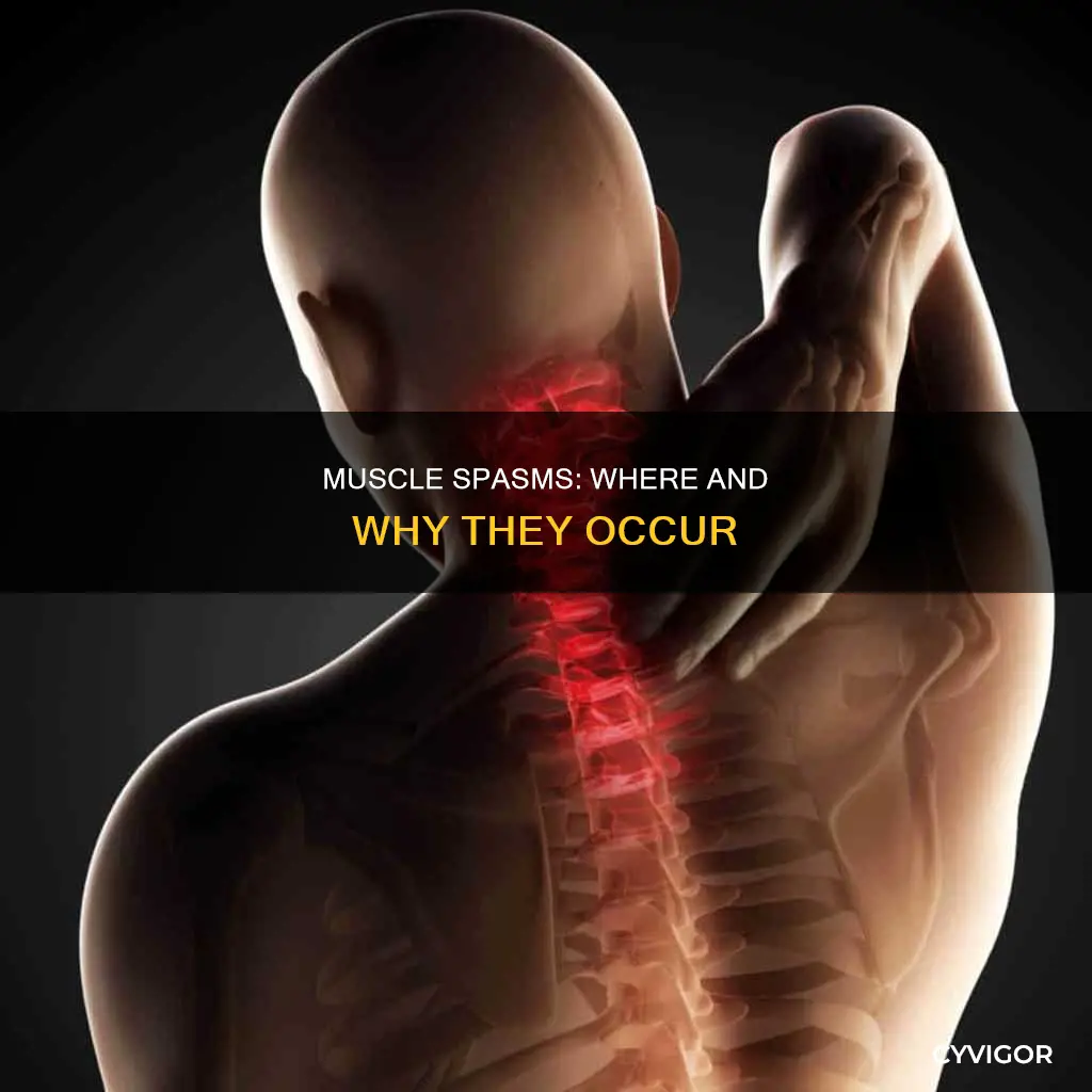 Muscle Spasms: Where And Why They Occur | CyVigor
