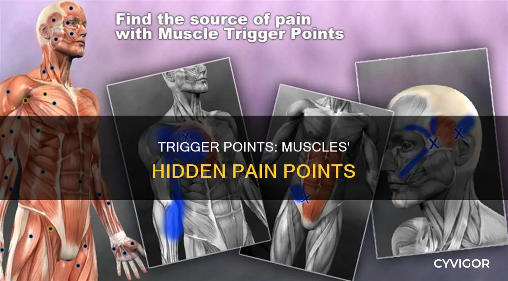 Trigger Points: Muscles' Hidden Pain Points | CyVigor