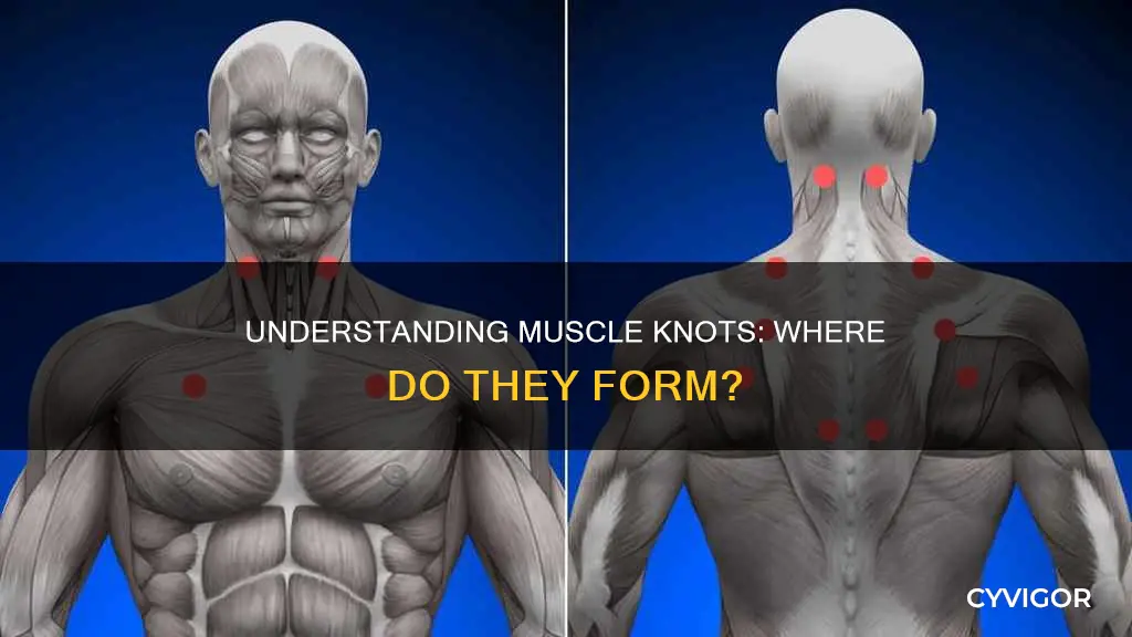 Understanding Muscle Knots: Where Do They Form? | CyVigor