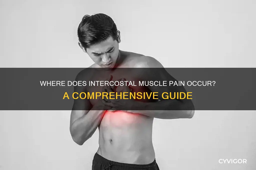 Where Does Intercostal Muscle Pain Occur? A Comprehensive Guide | CyVigor