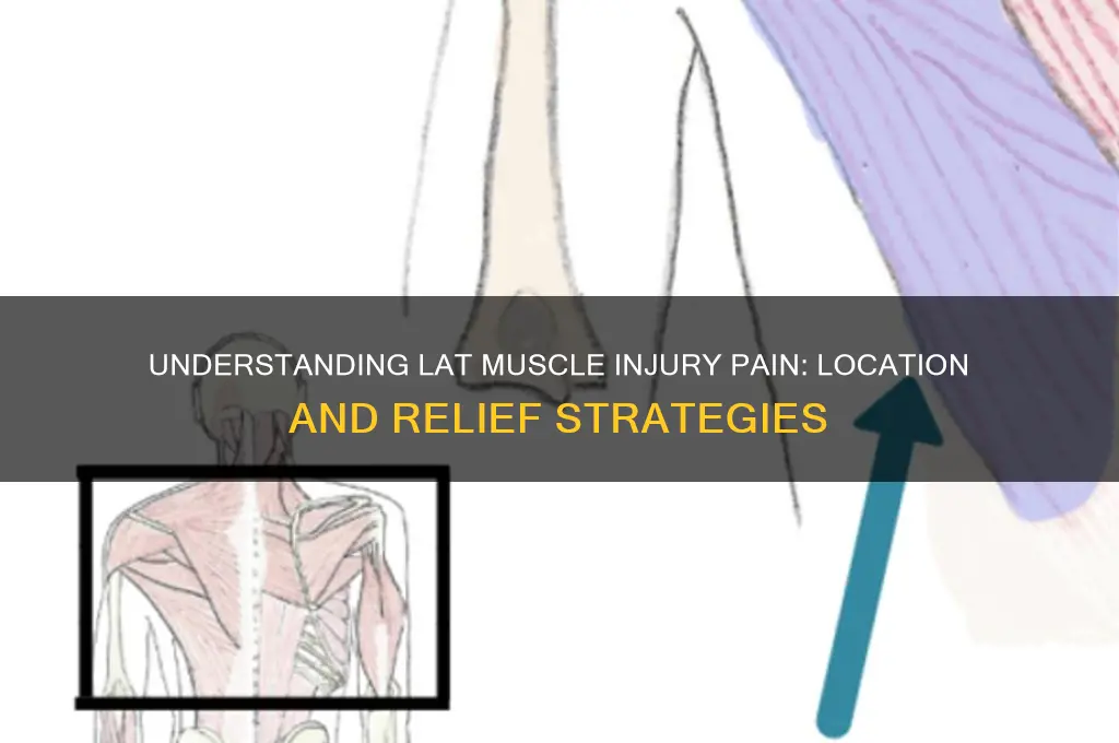 Understanding Lat Muscle Injury Pain: Location And Relief Strategies ...