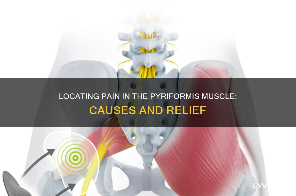 Locating Pain In The Pyriformis Muscle: Causes And Relief | CyVigor