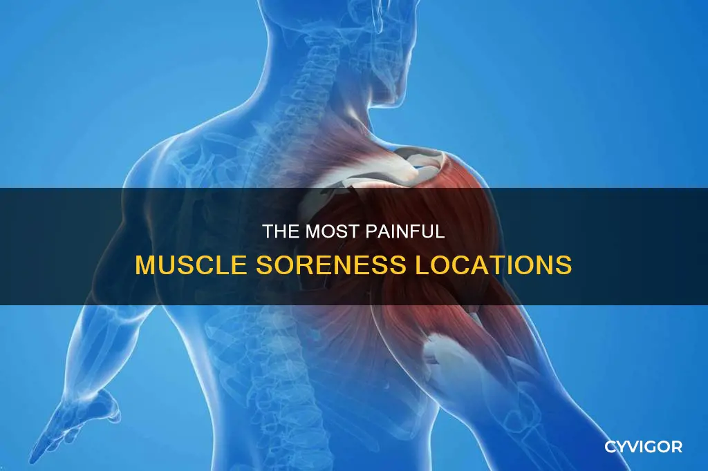 The Most Painful Muscle Soreness Locations | CyVigor
