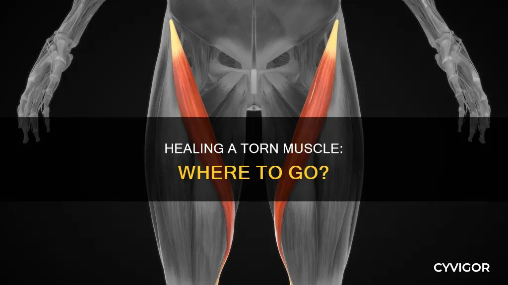 Healing A Torn Muscle: Where To Go? | CyVigor