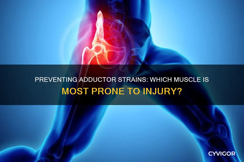 Preventing Adductor Strains: Which Muscle Is Most Prone To Injury ...