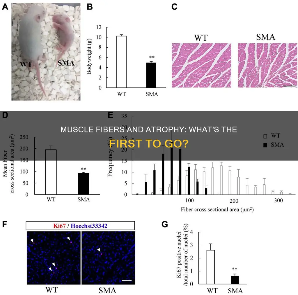 Muscle Fibers And Atrophy: What's The First To Go? | CyVigor