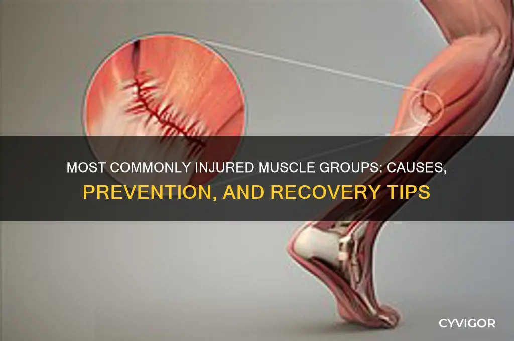 Most Commonly Injured Muscle Groups: Causes, Prevention, And Recovery ...