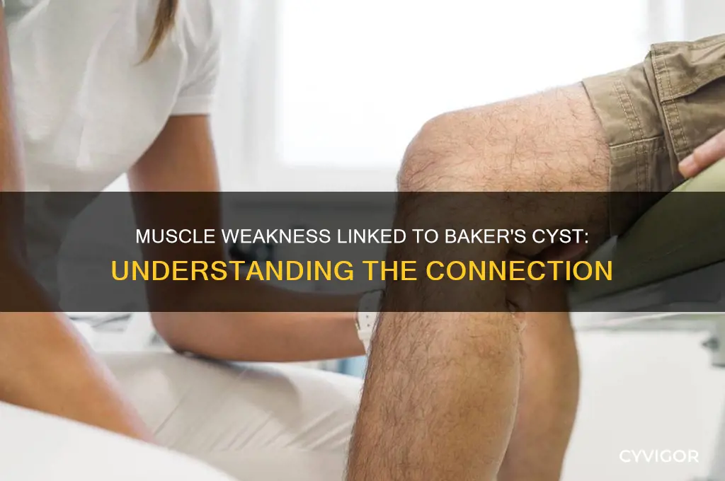 Muscle Weakness Linked To Baker's Cyst: Understanding The Connection ...