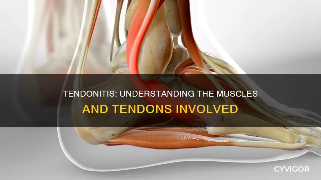 Tendonitis: Understanding The Muscles And Tendons Involved | CyVigor
