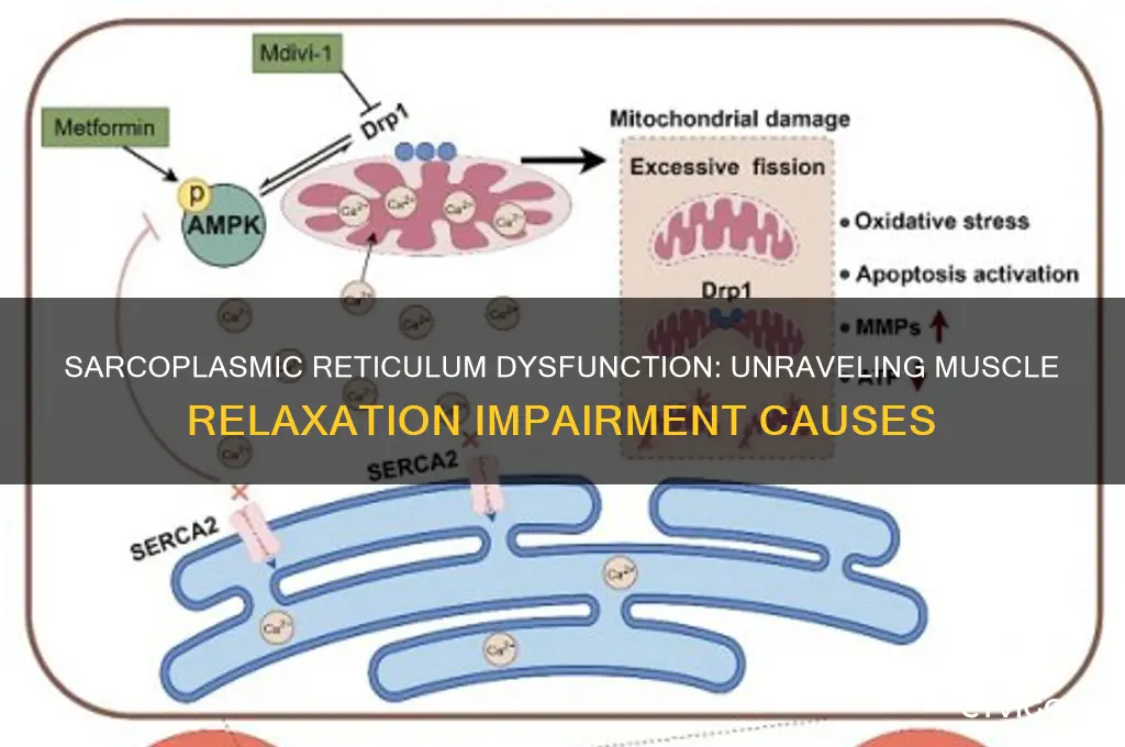 Sarcoplasmic Reticulum Dysfunction: Unraveling Muscle Relaxation ...