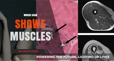 The Subcostal Muscles: Which Ribs Do They Attach To? | CyVigor