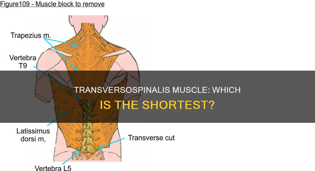 Transversospinalis Muscle: Which Is The Shortest? | CyVigor