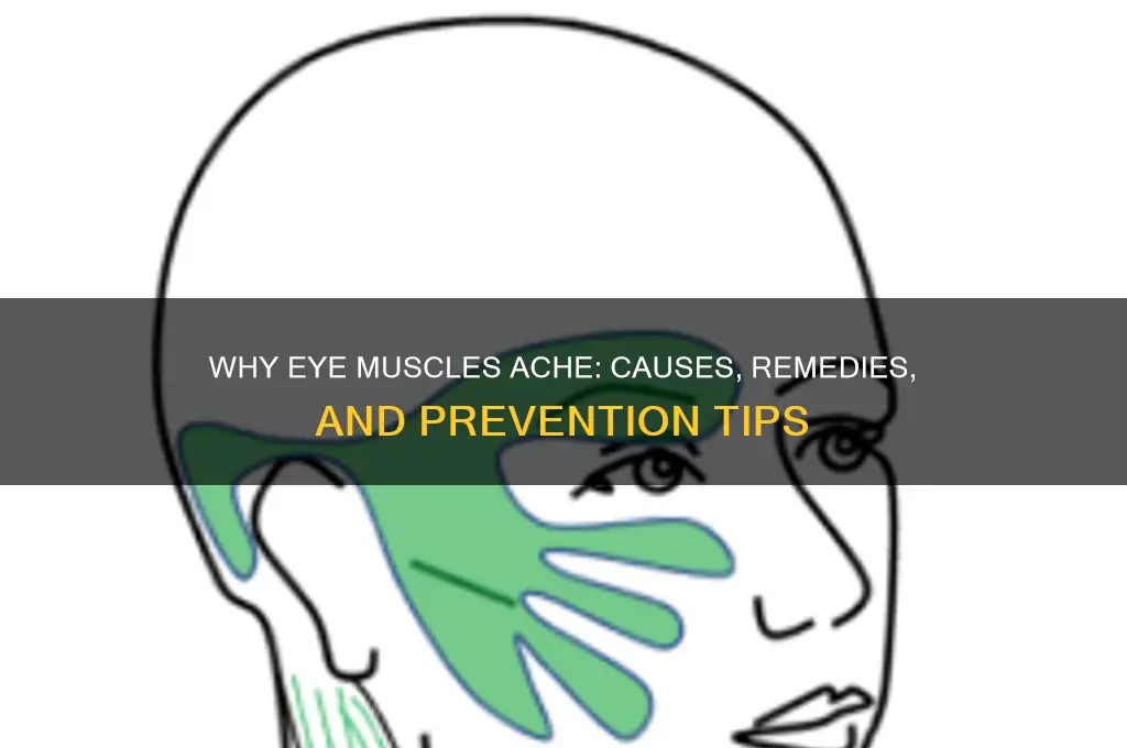 Why Eye Muscles Ache: Causes, Remedies, And Prevention Tips | CyVigor