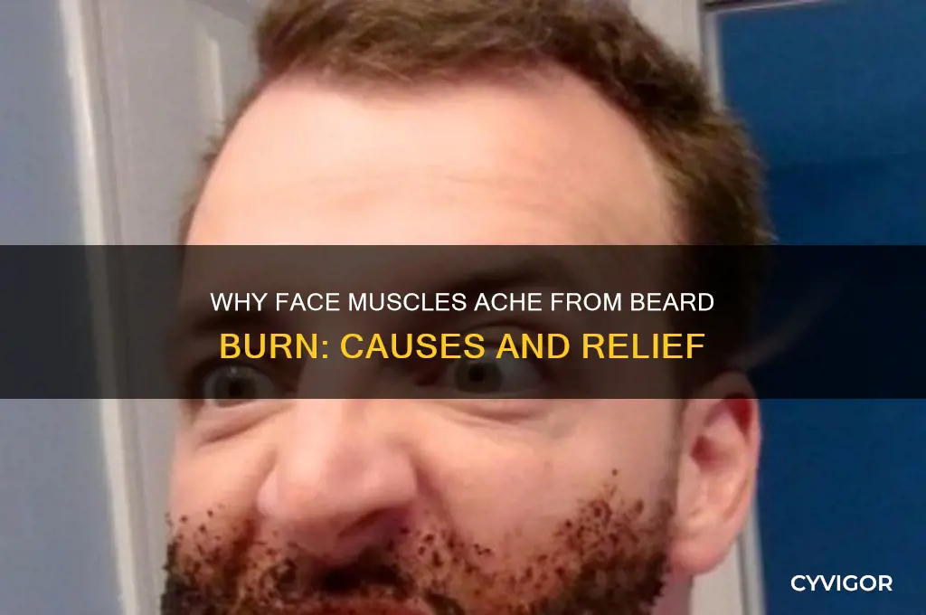 Why Face Muscles Ache From Beard Burn: Causes And Relief | CyVigor