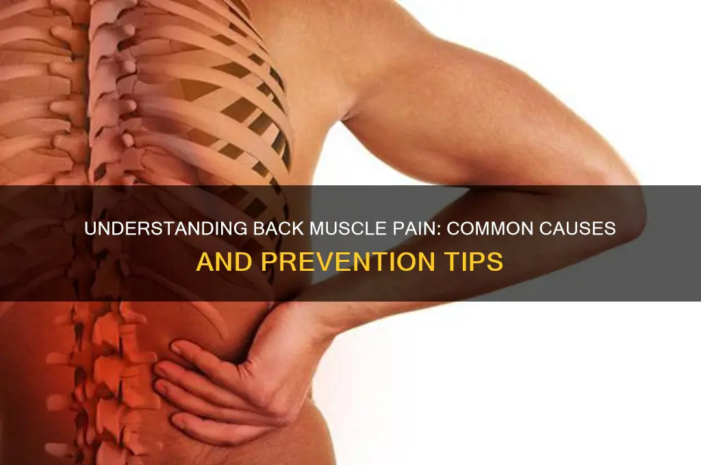 Understanding Back Muscle Pain: Common Causes And Prevention Tips | CyVigor