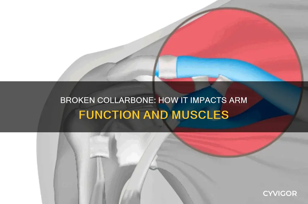 Broken Collarbone: How It Impacts Arm Function And Muscles | CyVigor