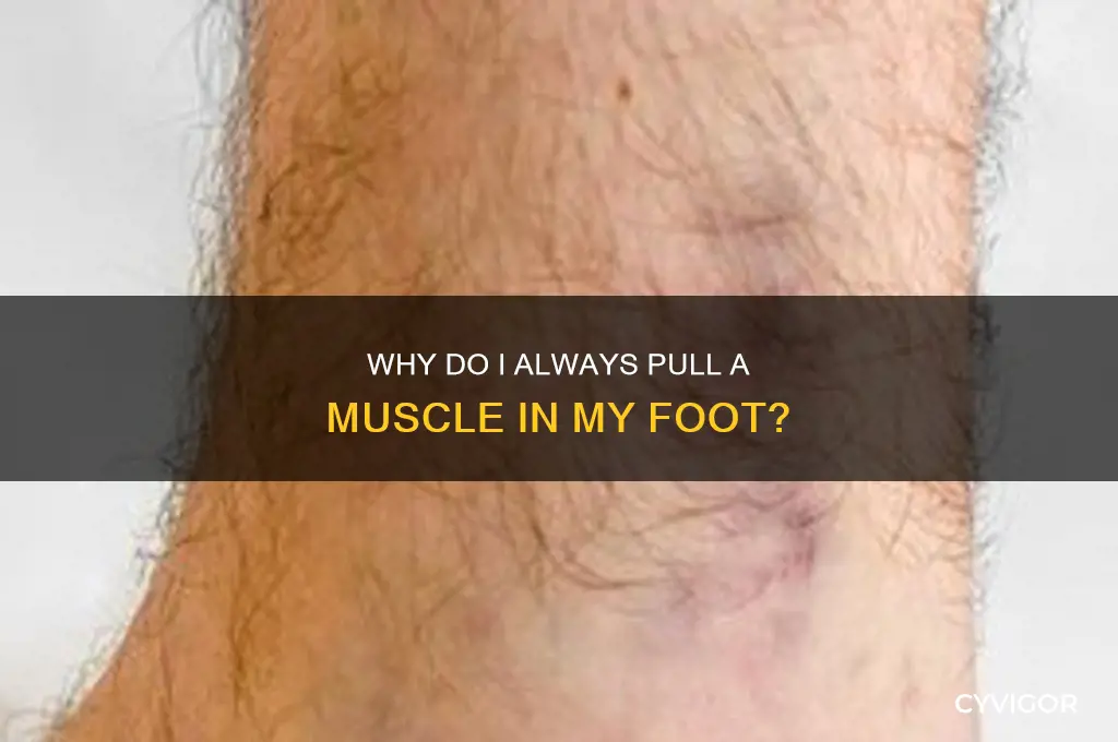 Why Do I Always Pull A Muscle In My Foot? | CyVigor