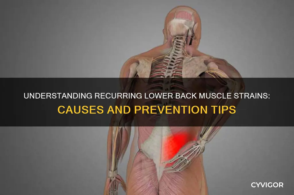 Understanding Recurring Lower Back Muscle Strains: Causes And ...