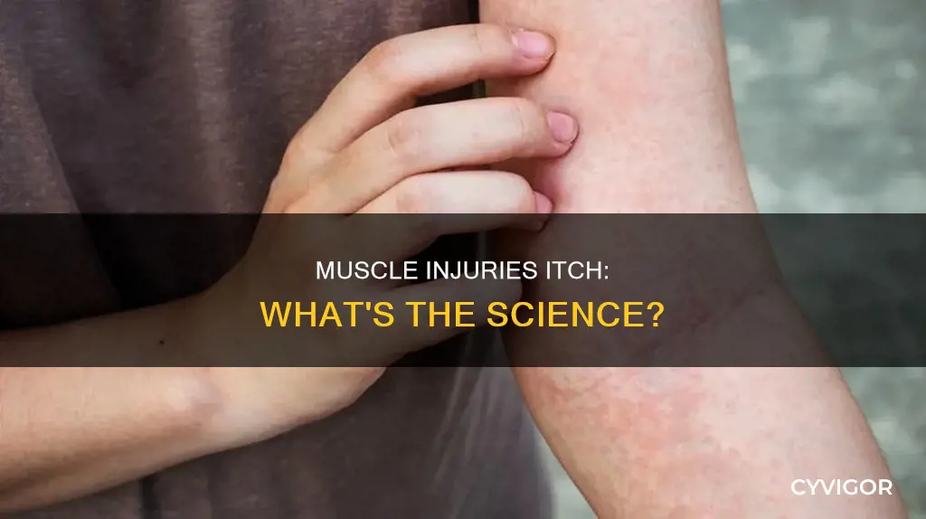 Muscle Injuries Itch: What's The Science? | CyVigor
