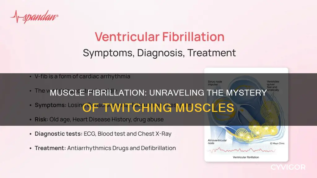 Muscle Fibrillation: Unraveling The Mystery Of Twitching Muscles | CyVigor