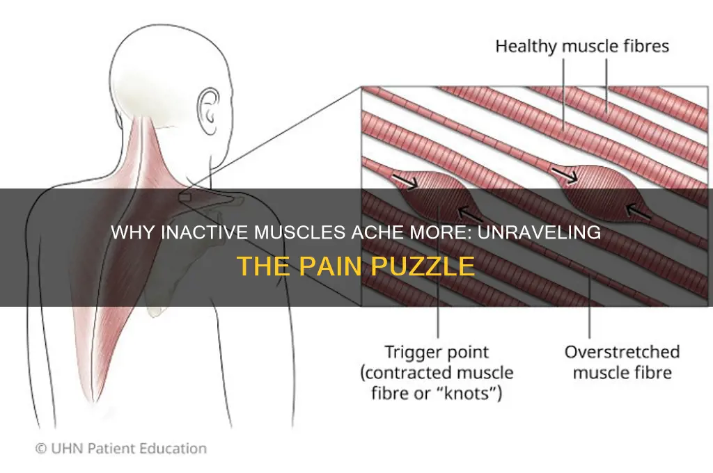 Why Inactive Muscles Ache More: Unraveling The Pain Puzzle | CyVigor