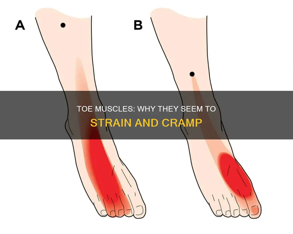 Toe Muscles: Why They Seem To Strain And Cramp | CyVigor