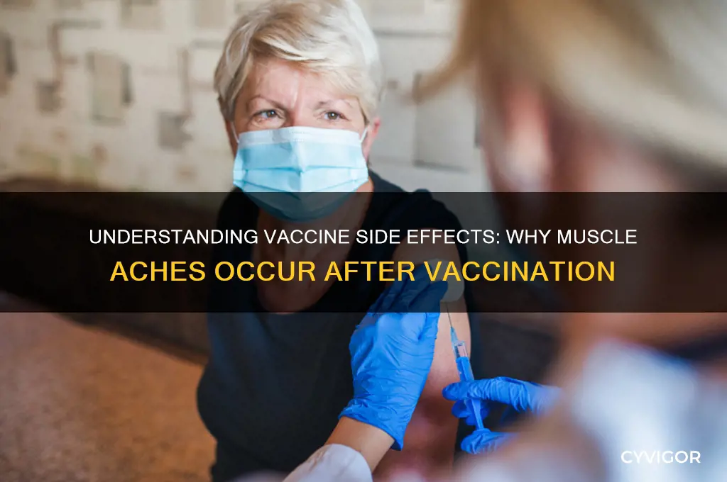 Understanding Vaccine Side Effects: Why Muscle Aches Occur After ...