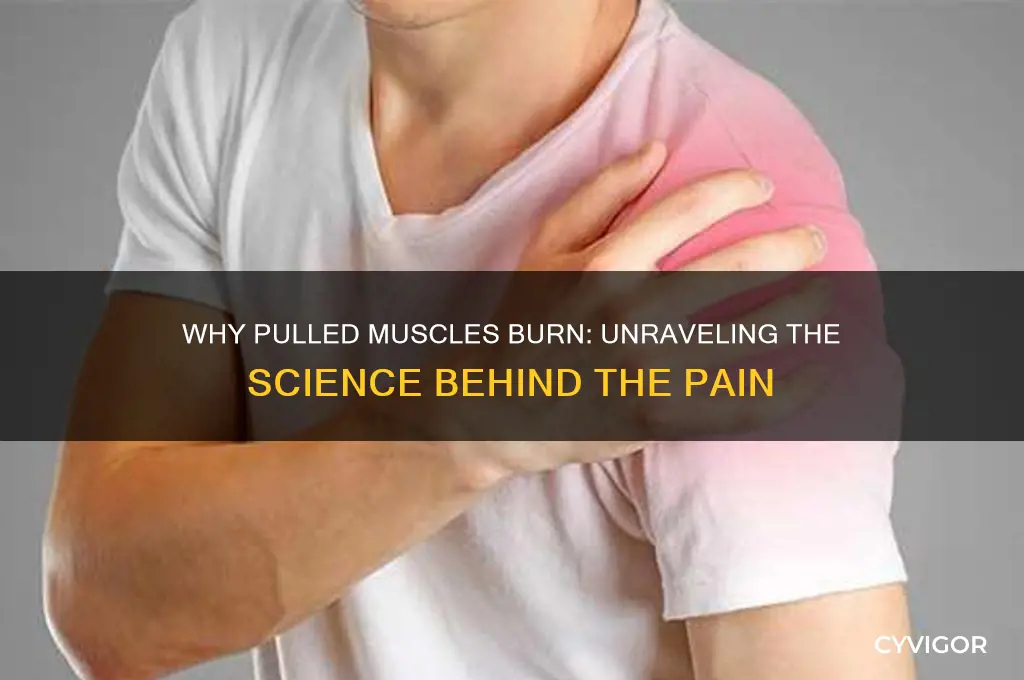 Why Pulled Muscles Burn: Unraveling The Science Behind The Pain | CyVigor
