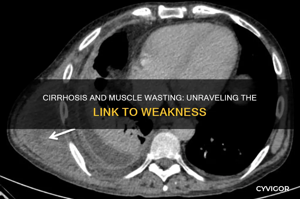 Cirrhosis And Muscle Wasting: Unraveling The Link To Weakness | CyVigor