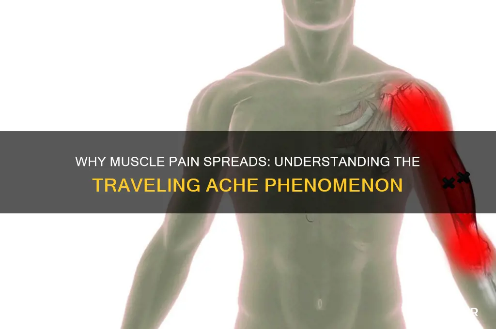 Why Muscle Pain Spreads: Understanding The Traveling Ache Phenomenon ...