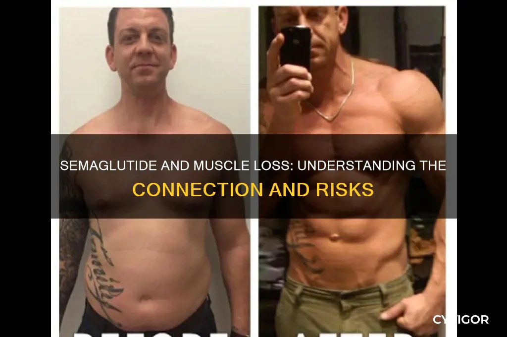 Semaglutide And Muscle Loss: Understanding The Connection And Risks ...