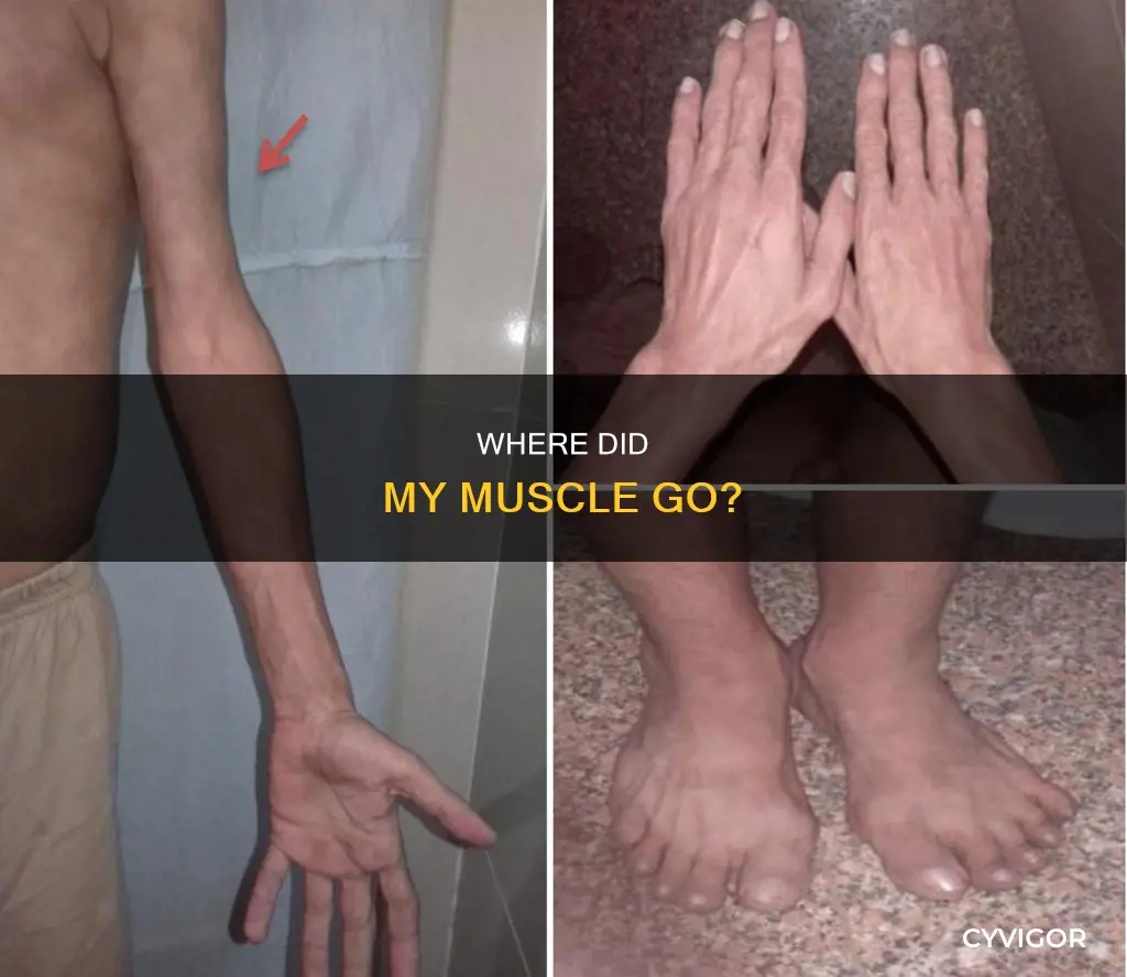 Where Did My Muscle Go? | CyVigor