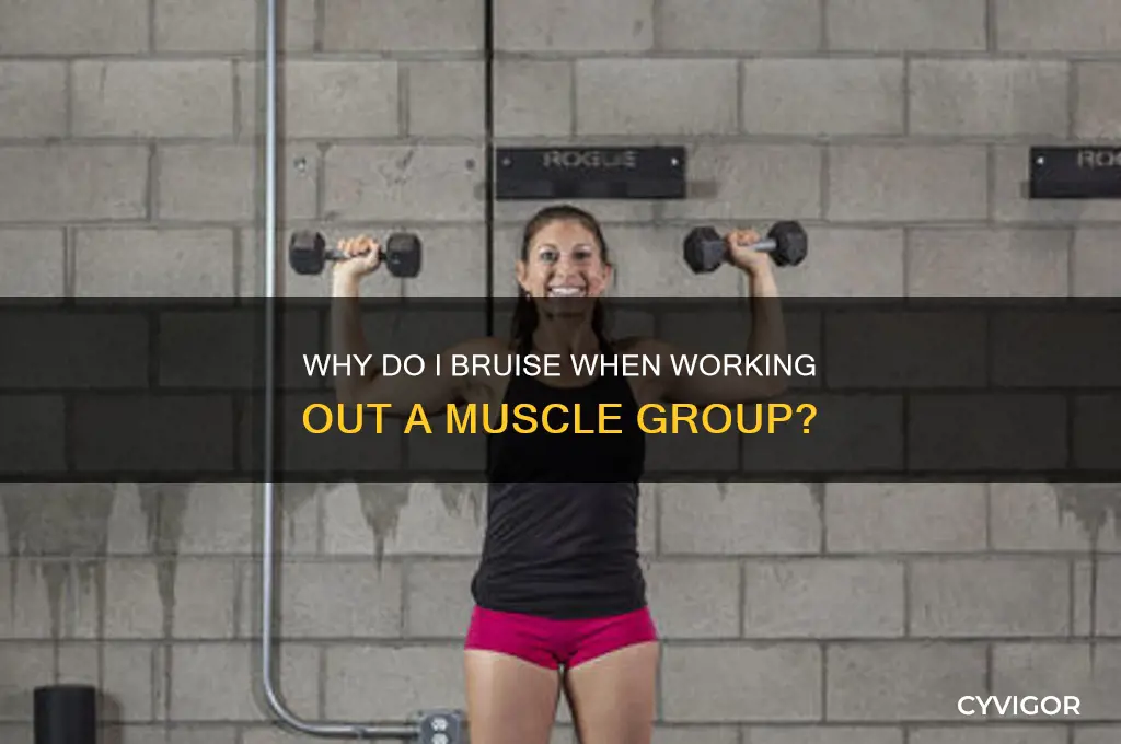 Why Do I Bruise When Working Out A Muscle Group? | CyVigor
