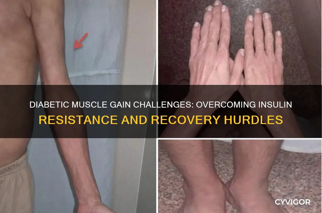 Diabetic Muscle Gain Challenges: Overcoming Insulin Resistance And ...