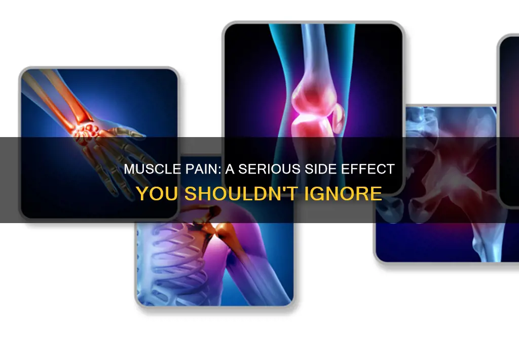 Muscle Pain: A Serious Side Effect You Shouldn't Ignore | CyVigor