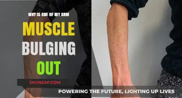 Why Your Arm Muscle Vibrates: Causes, Concerns, And Solutions Explained ...