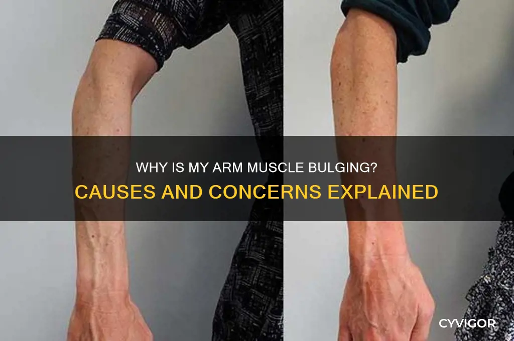 Why Is My Arm Muscle Bulging? Causes And Concerns Explained | CyVigor